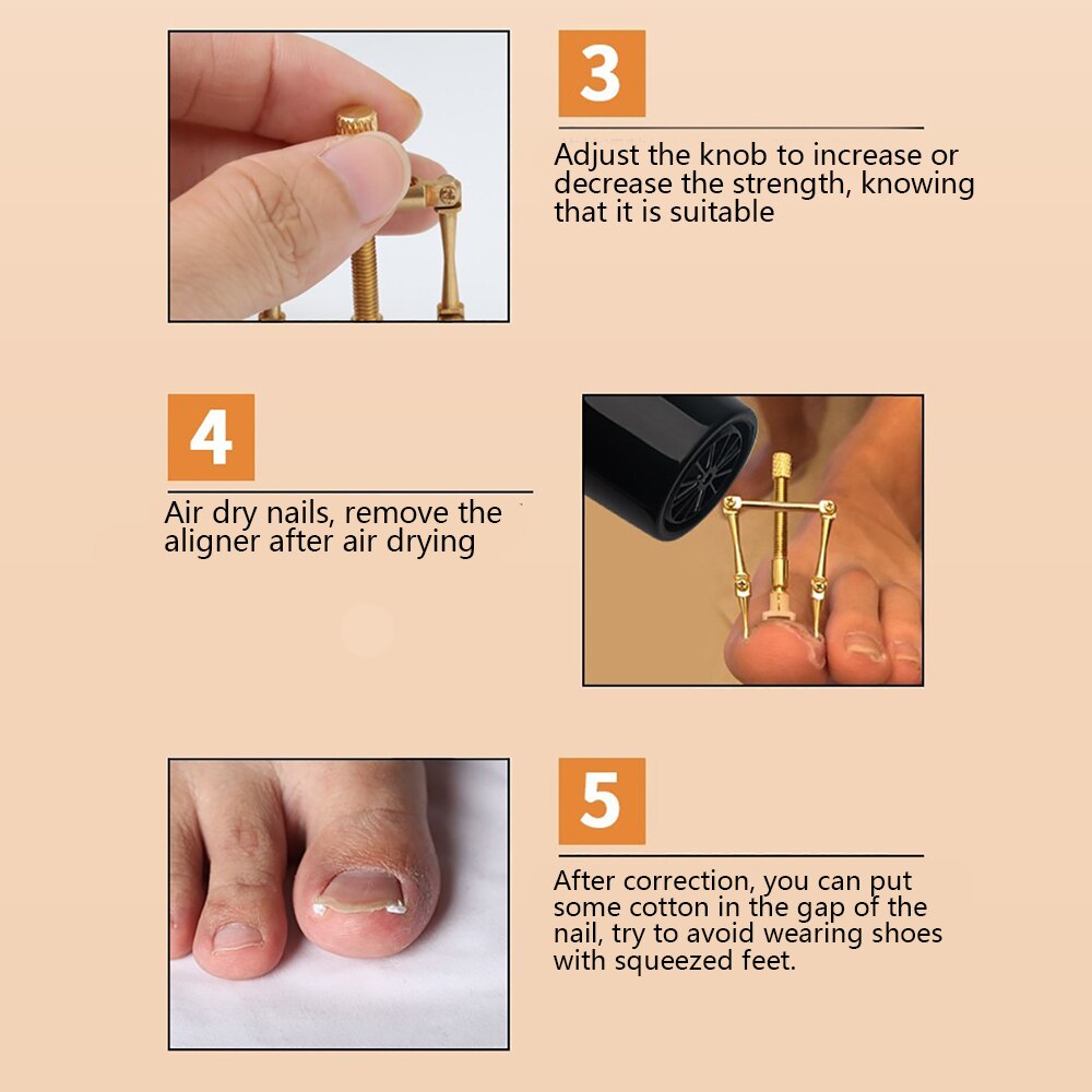 Ingrown toe pedicure foot care nail care tool foot... – Vicedeal