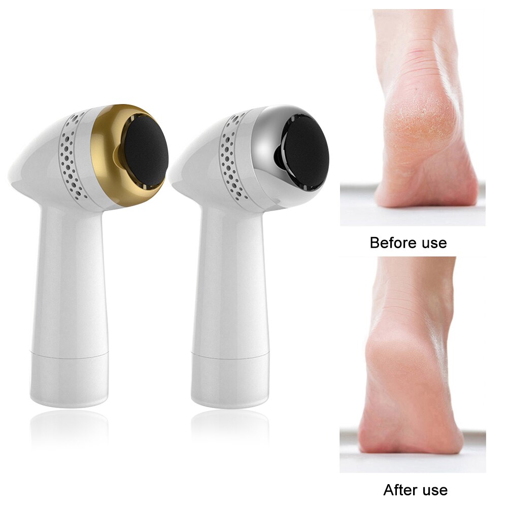 USB Charging Foot Grinder Dead Skin Remover Foot F... – Grandado