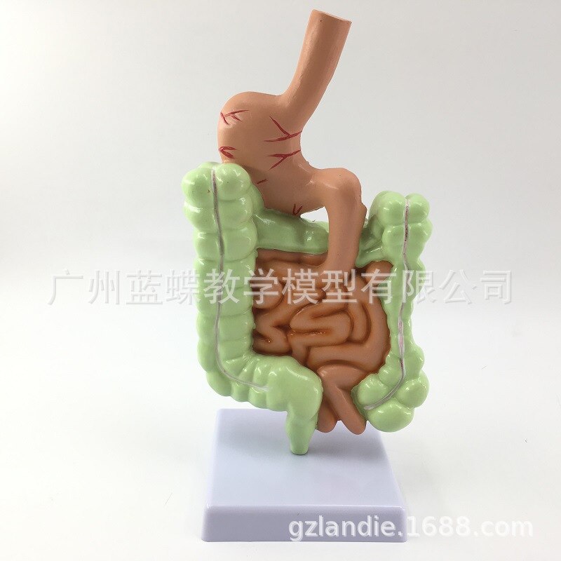 Pathological model of large intestine stomach mode... – Vicedeal