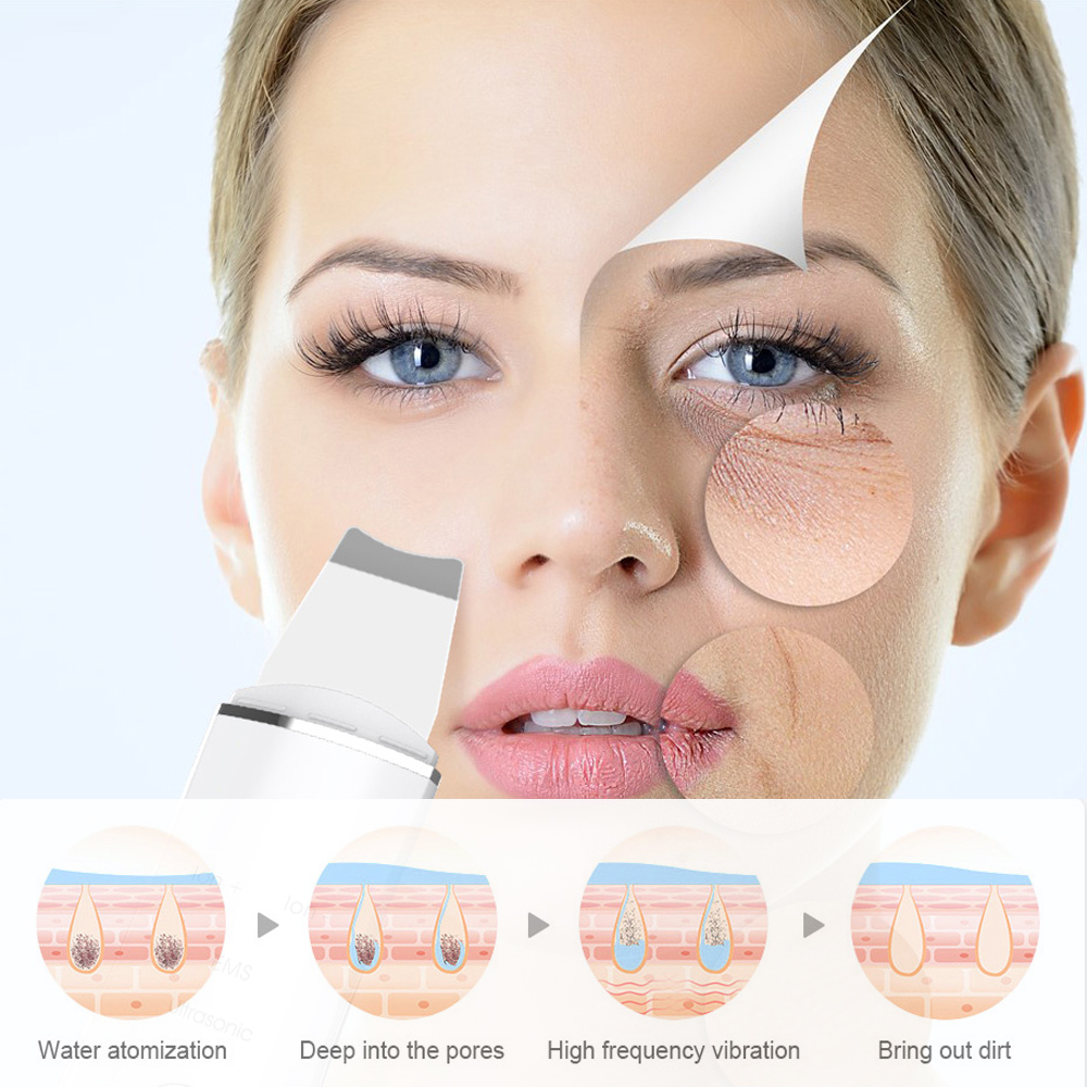Rechargeable Ultrasonic Face Skin Scrubber Deep Fa... – Vicedeal