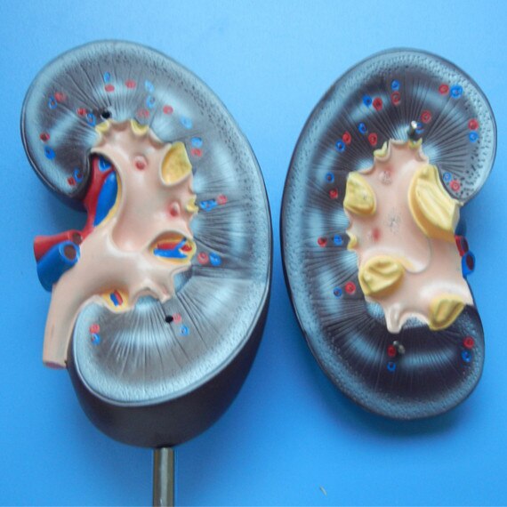 ISO Anatomisches Modell der Niere, niere Modell – Vicedeal