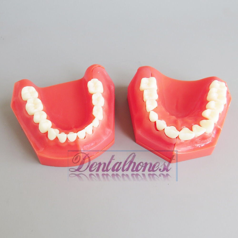 Dental Model #4006 01 - Teeth Eruption Development... – Vicedeal