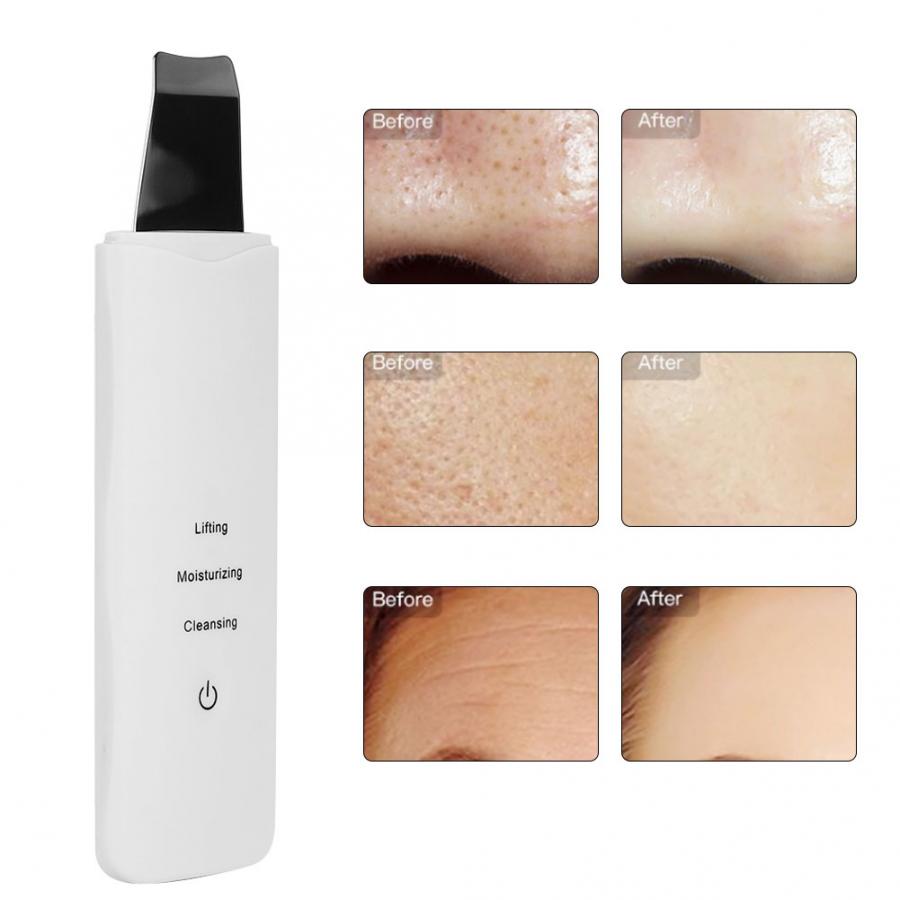 Ultrasone Gezicht Huid Scrubber Porie Cleanser Lif... – Vicedeal