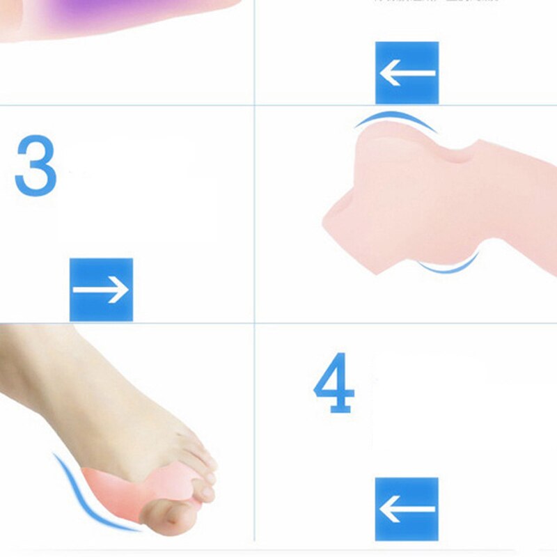 2Pcs Silicone Gel Toe Separator Metatarsal Bunion ... – Grandado