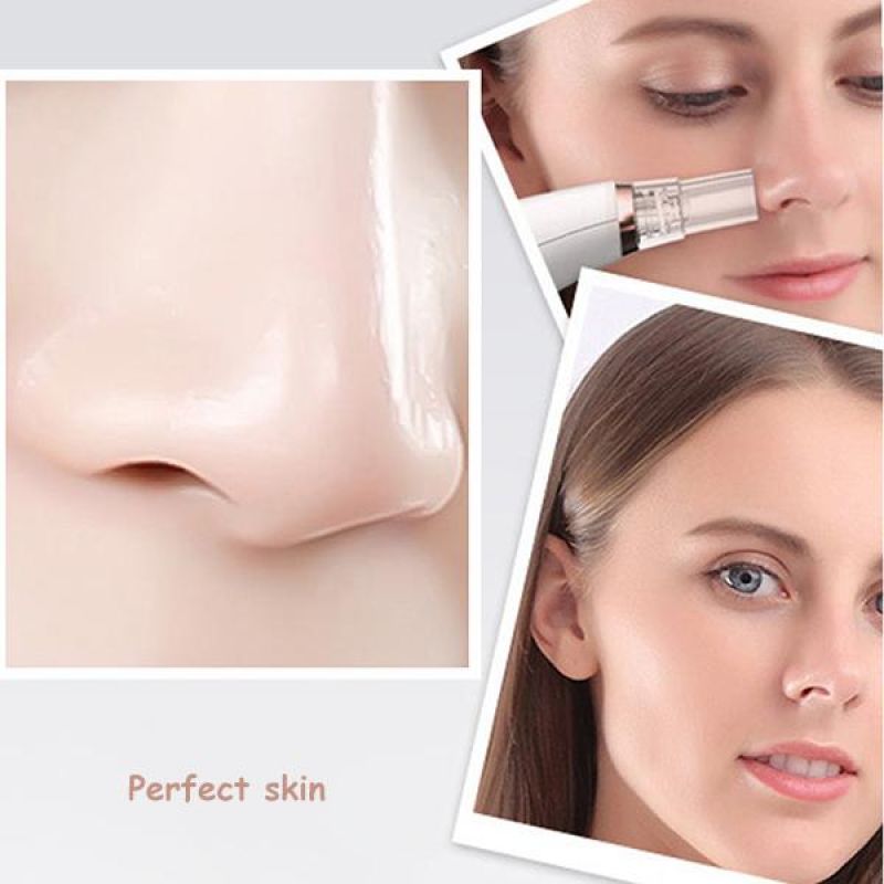 Electric Blackhead Remover Point Noir Blackhead Va... – Vicedeal