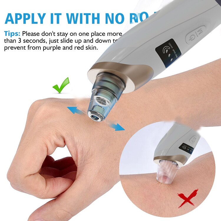 Blackhead Remover Electric Vacuum Suction Pore Cle... – Grandado