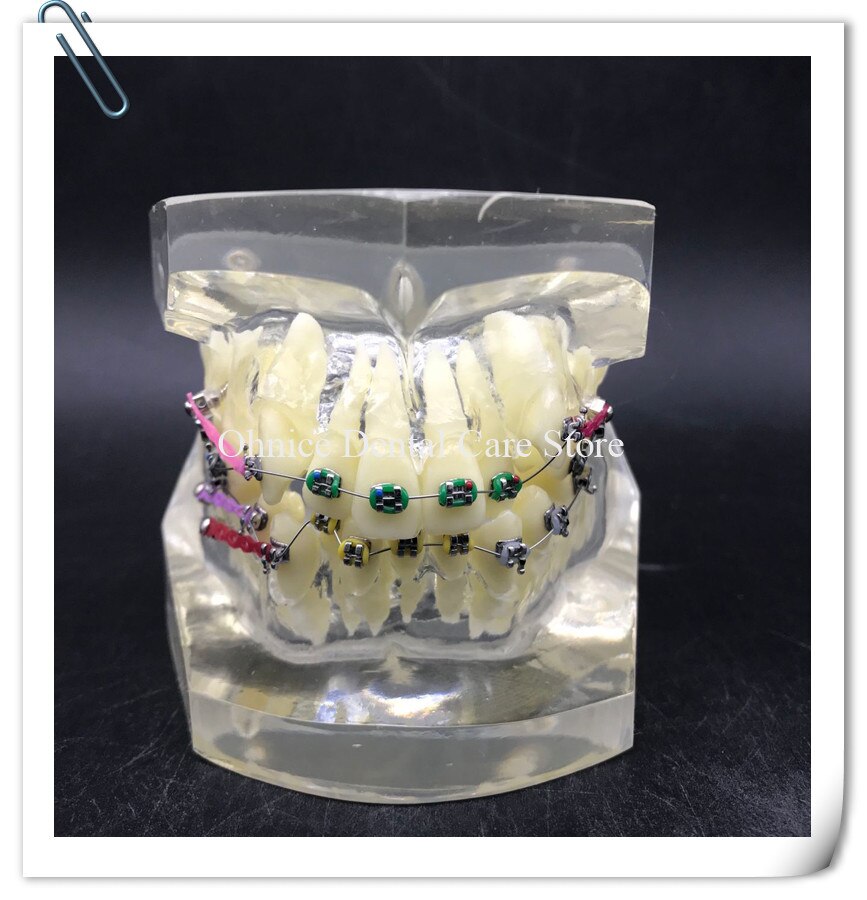 Orthodontic study teeth model M3005 with buccal tu... – Vicedeal
