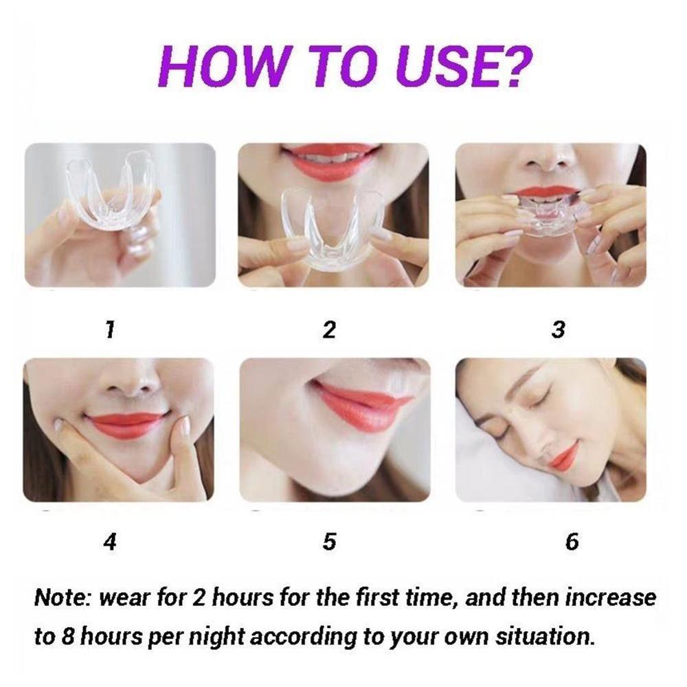 Orthodontic Braces Dental Braces Instanted Silicon... – Vicedeal