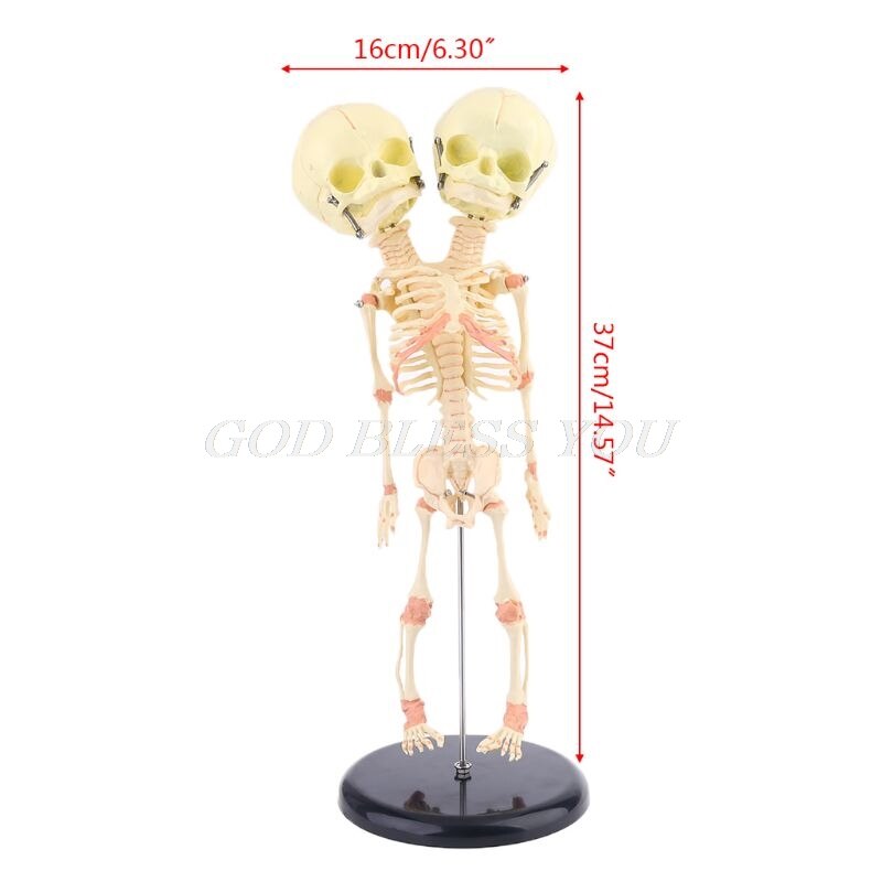 Human Double Head Baby Skull Research Model Skelet... – Vicedeal