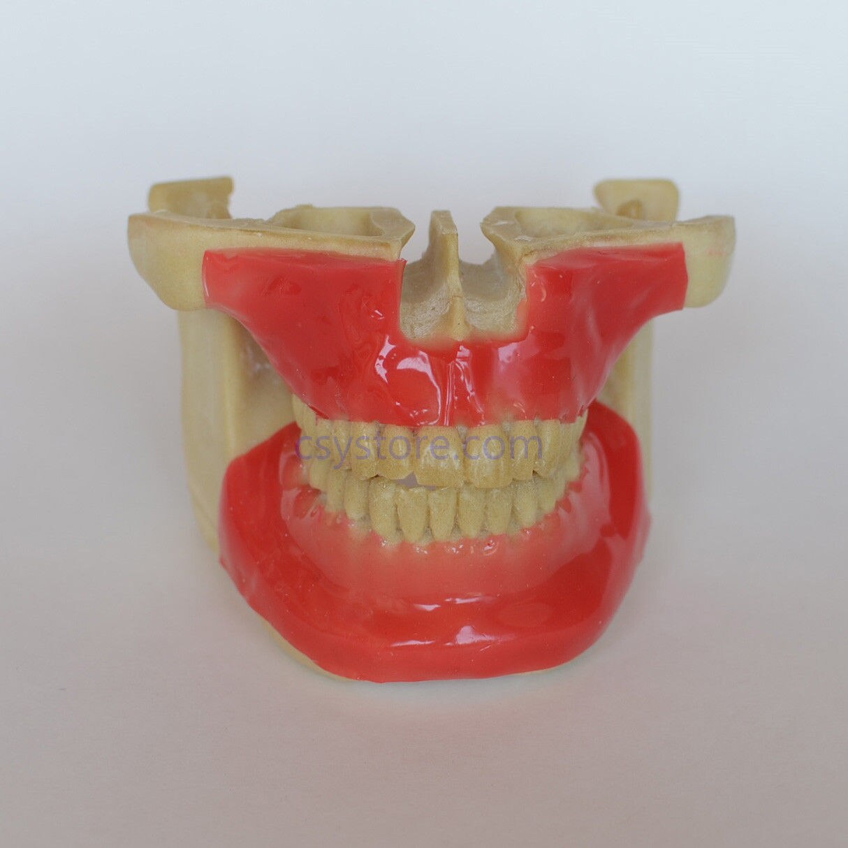 Dental Model #203101 Orthodontic Anchor Implant Sc... – Grandado