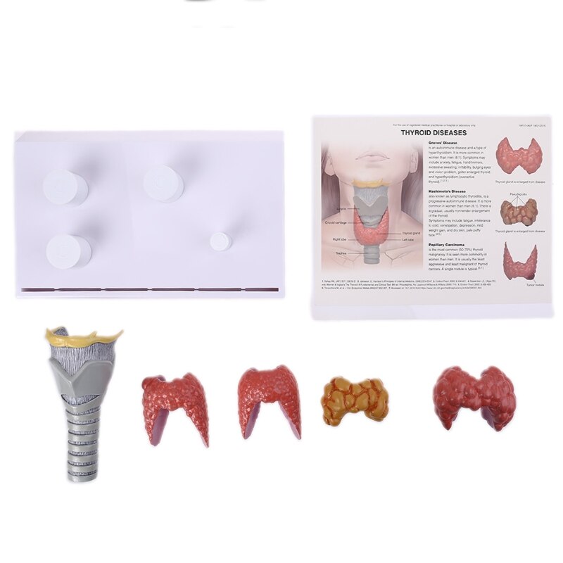 Human Anatomisch Schildklier Model Pathologie Anat... – Vicedeal