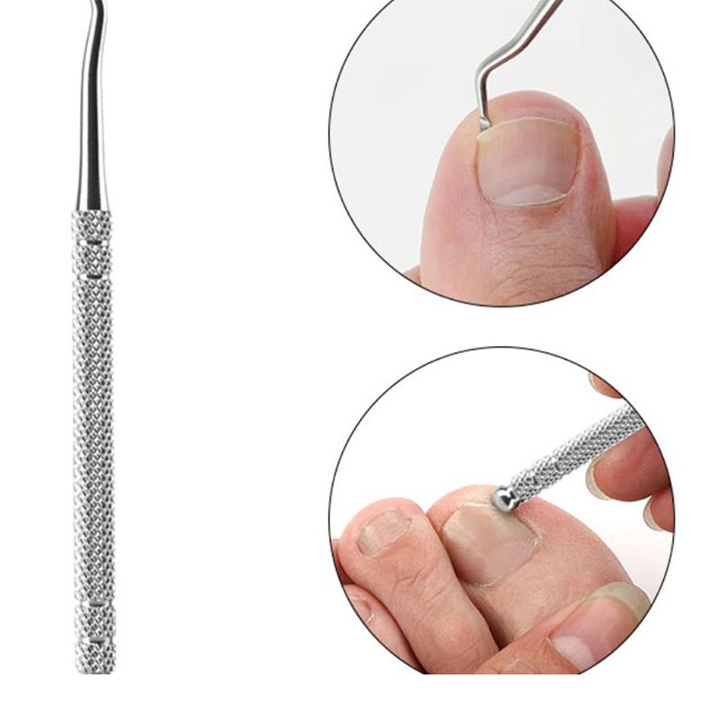 Ingrown Toe Nail Fixer Pedicure Recover Embed Toen... – Grandado