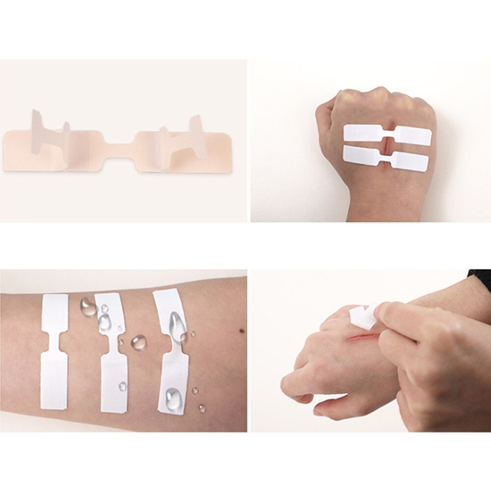 20PCs/Box Waterproof Band Aid Butterfly Adhesive W... – Grandado