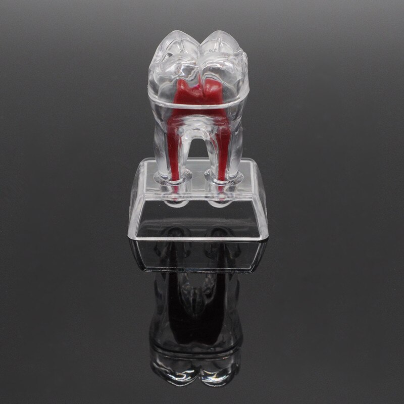 Dentist Lab Separable Teeth Molar Model Teaching D... – Vicedeal