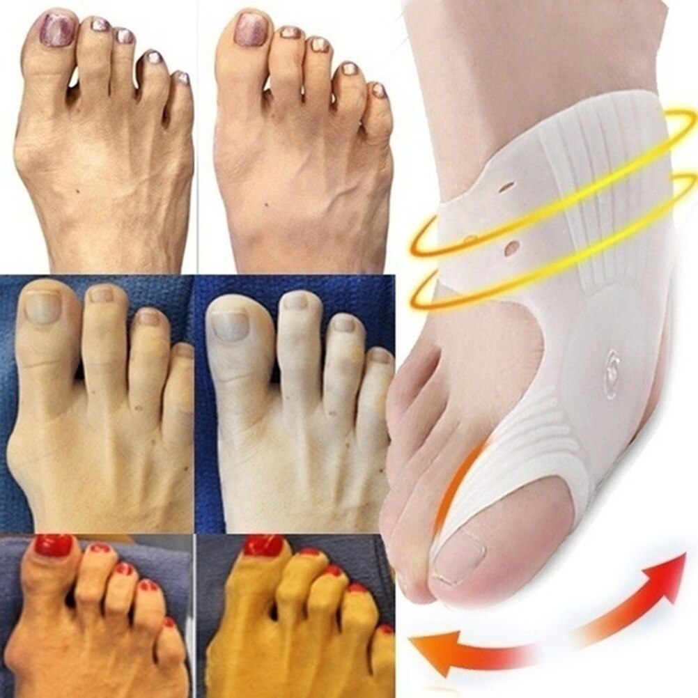 2Pcs Gel Big Toe Separator Bunion Corrector Toe St... – Vicedeal