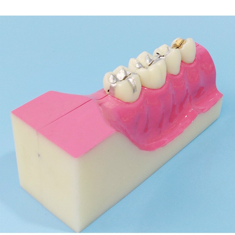 right lower tooth Tissue decomposition model Denta... – Grandado
