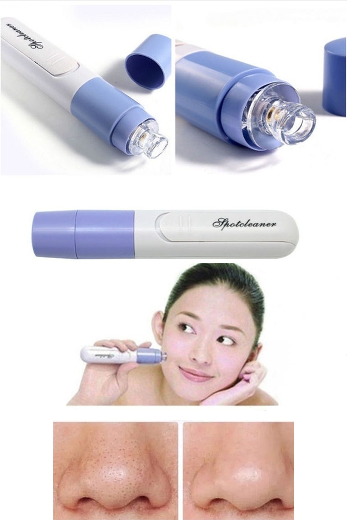 Pore Cleaner Vacuum Facial Cleansing Blackhead Cle... – Grandado