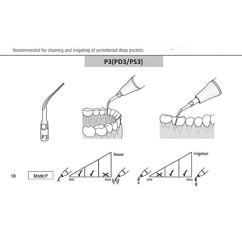 5 pcs PD3 dental scaler tips dental equipment teet... – Vicedeal