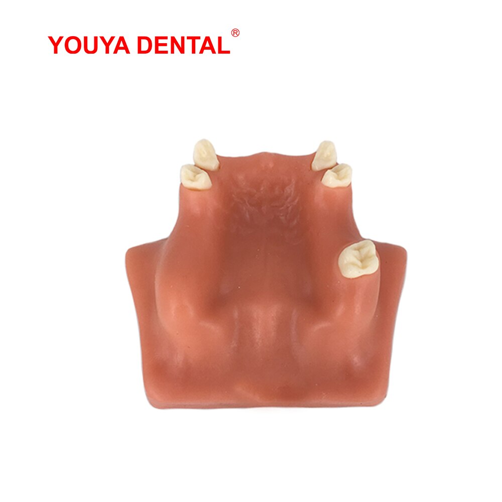 Dental Model Teeth Implant Practice Model Maxillar... – Grandado