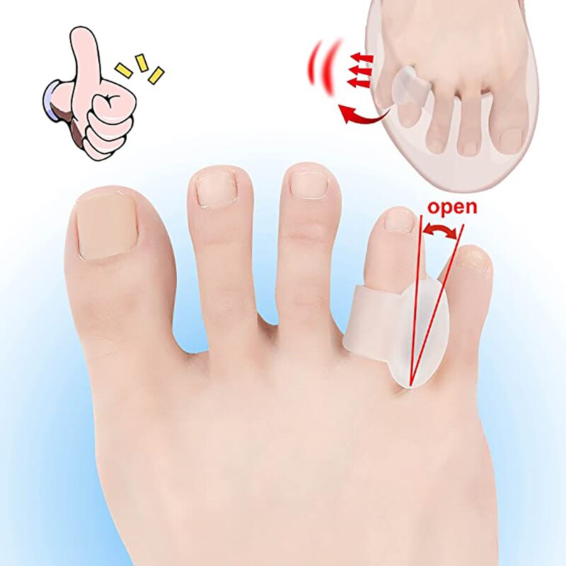2pcs/4pcs Toe Separator Insoles Ring Separation Ha... – Vicedeal