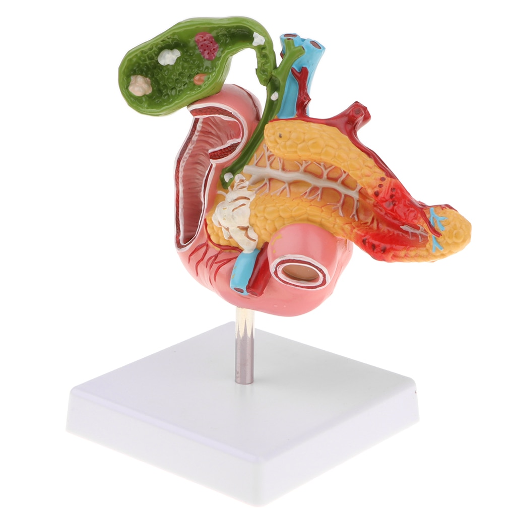 1:1 Life Size Anatomical Human Pancreas Duodenum G... – Grandado