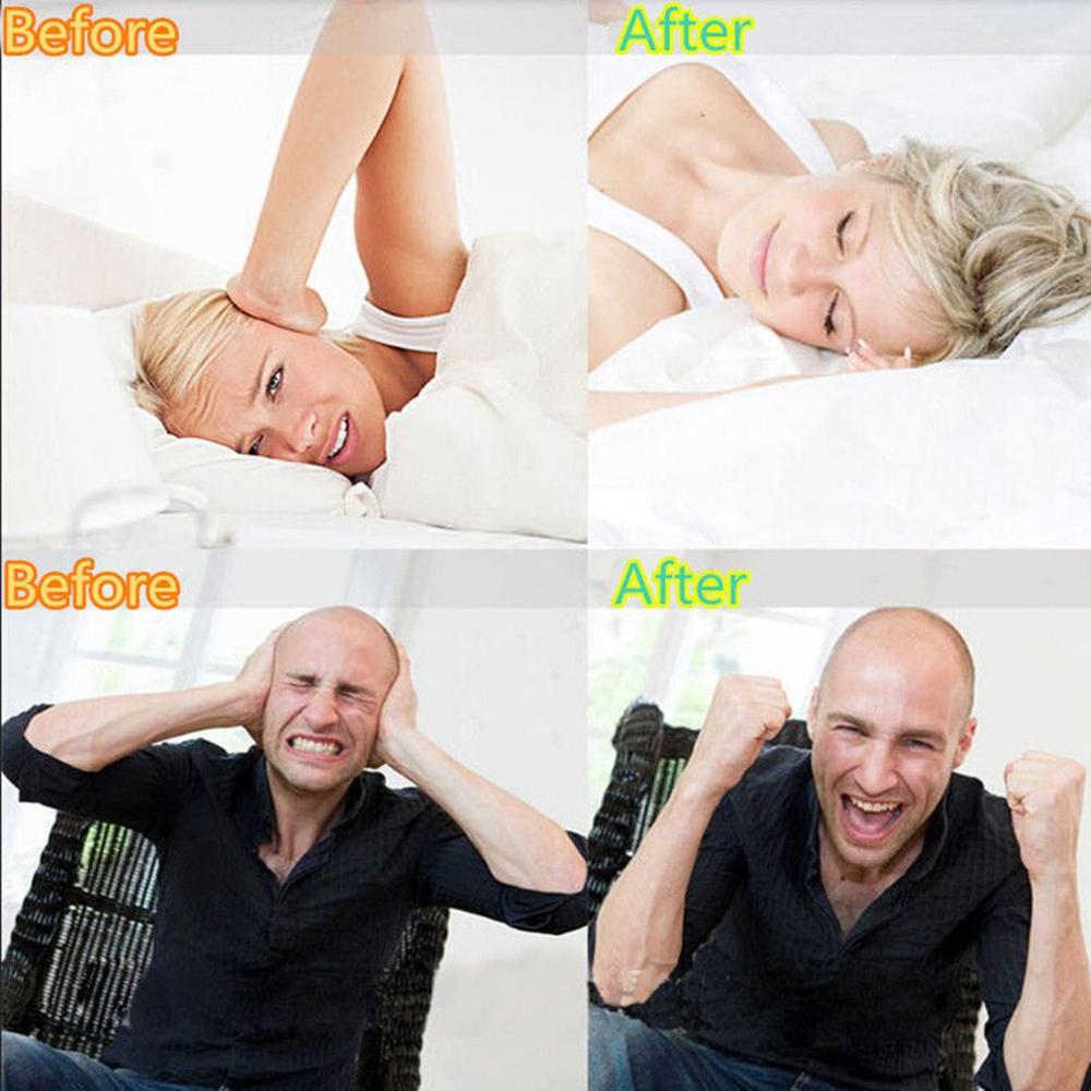 Food Grade EVA Anti Snoring Protective Cover Anti ... – Grandado