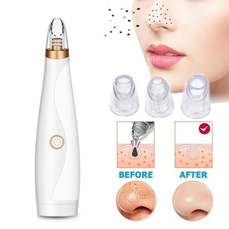 Blackhead Remover Face Deep Pore Cleaner Acne Pimp... – Vicedeal
