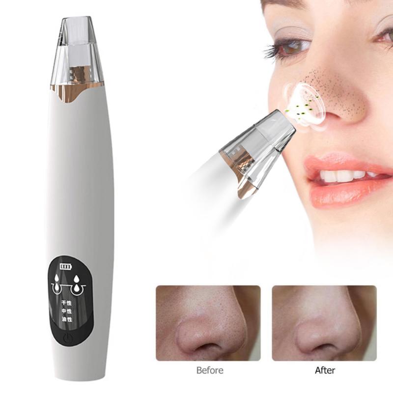 Electric Acne Remover Point Noir Blackhead Vacuum ... – Vicedeal