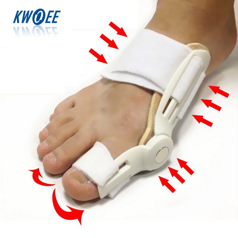 1 Lot=2 Pairs Hallux Valgus Aligner Foot Thumb Reh... – Grandado