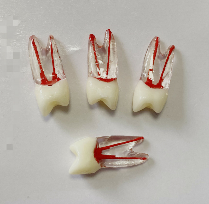 1~100pcs Dental Blocks Files Practice Red Pulp Roo... – Grandado