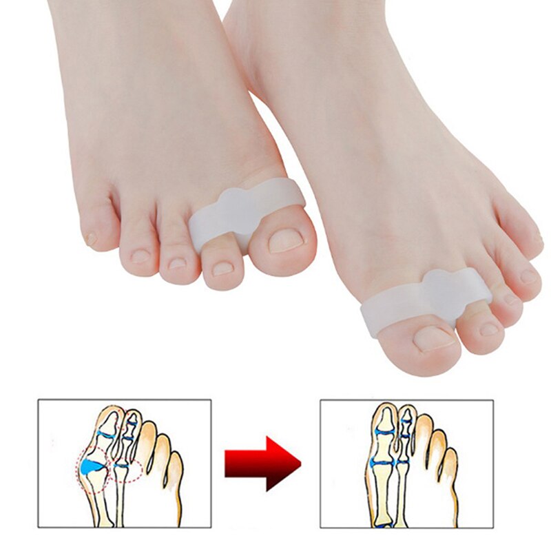 20Pair Interdigital Toe Separators Silicone Hallux... – Vicedeal