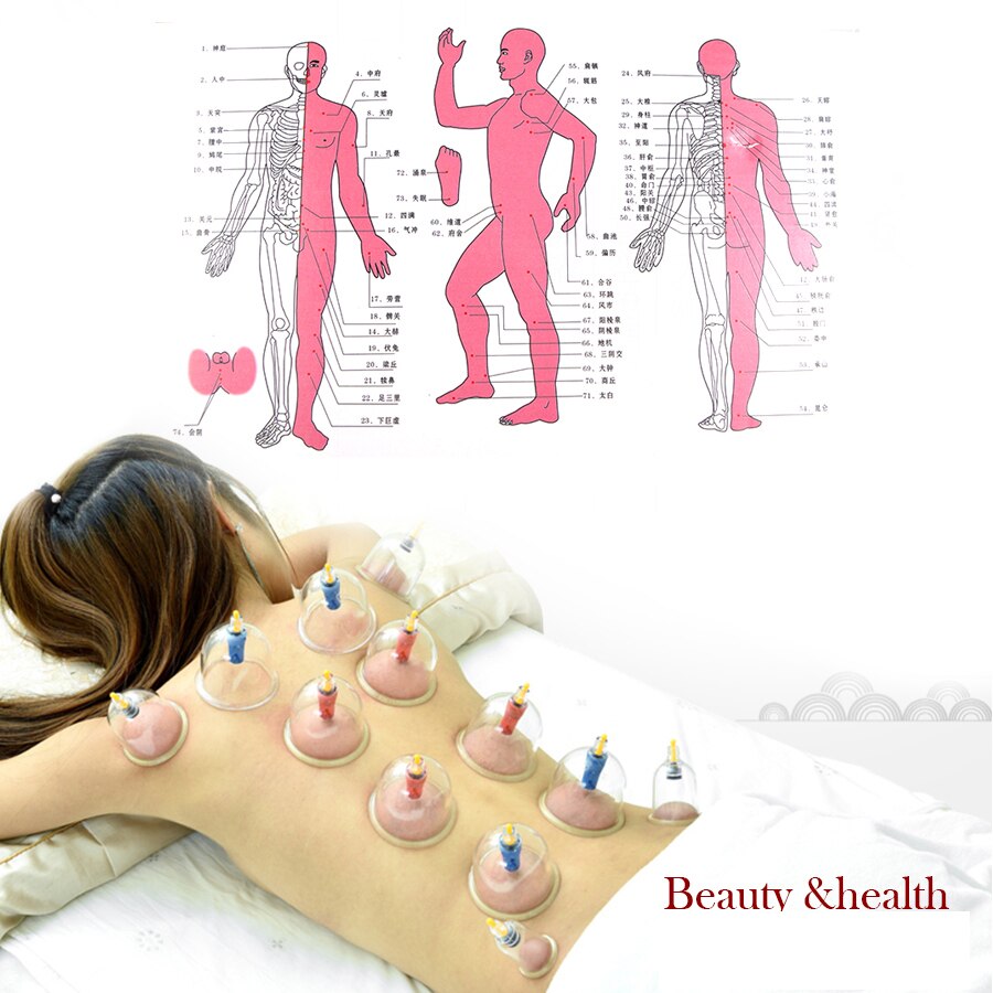 Ophax 24 Pcs Vacuüm Cupping Massage Blikjes Out Zu... – Vicedeal