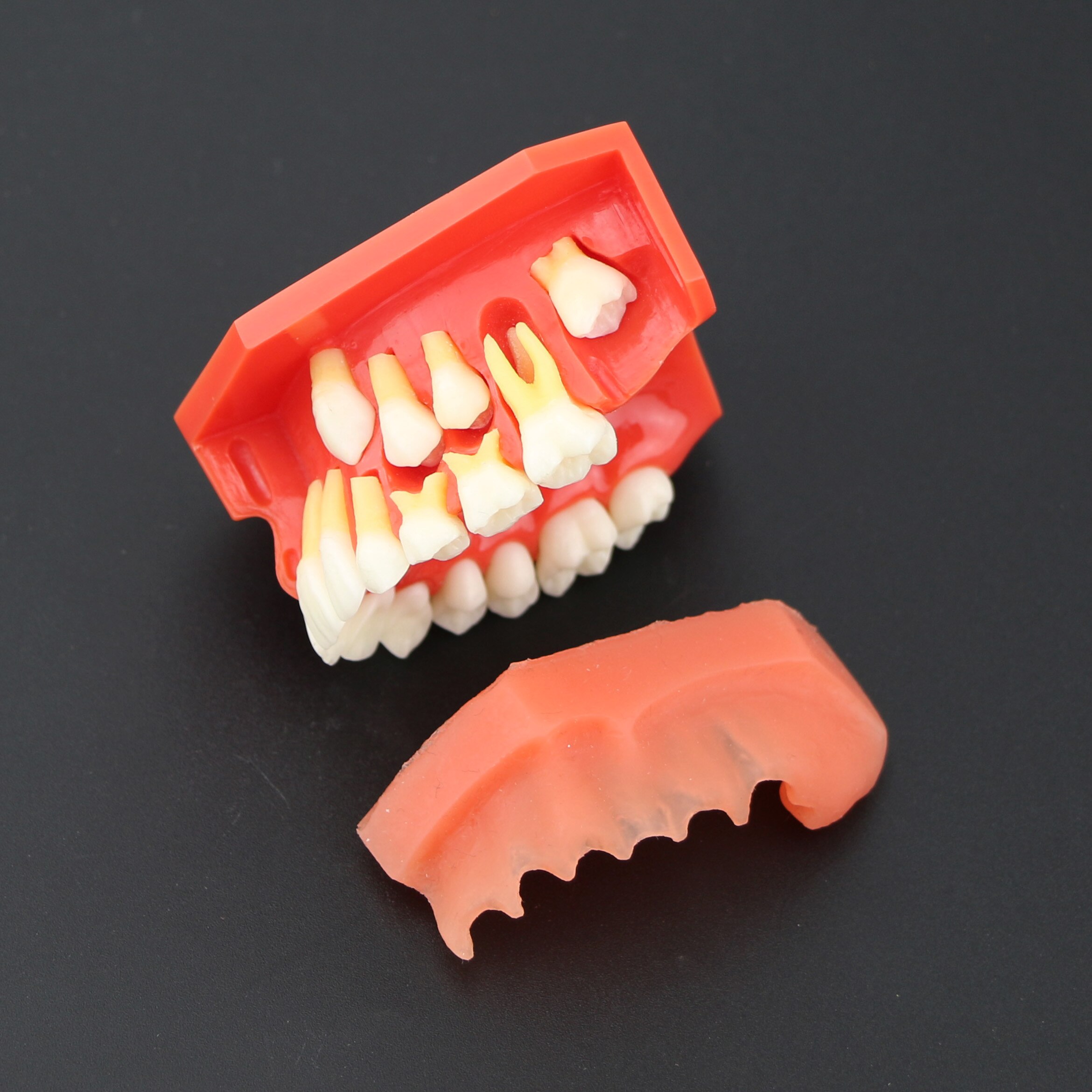Dental Teeth Model M7013 Typodont Pediatric Develo... – Grandado