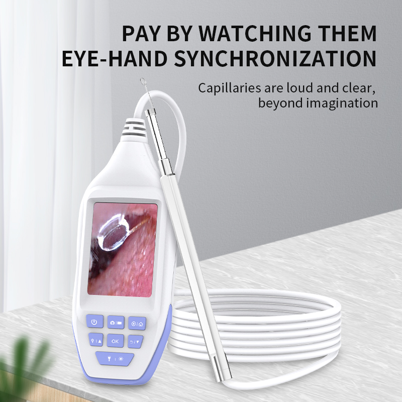 3.9MM Digital Otoscope 3" IPS Screen Ear Endo... – Vicedeal