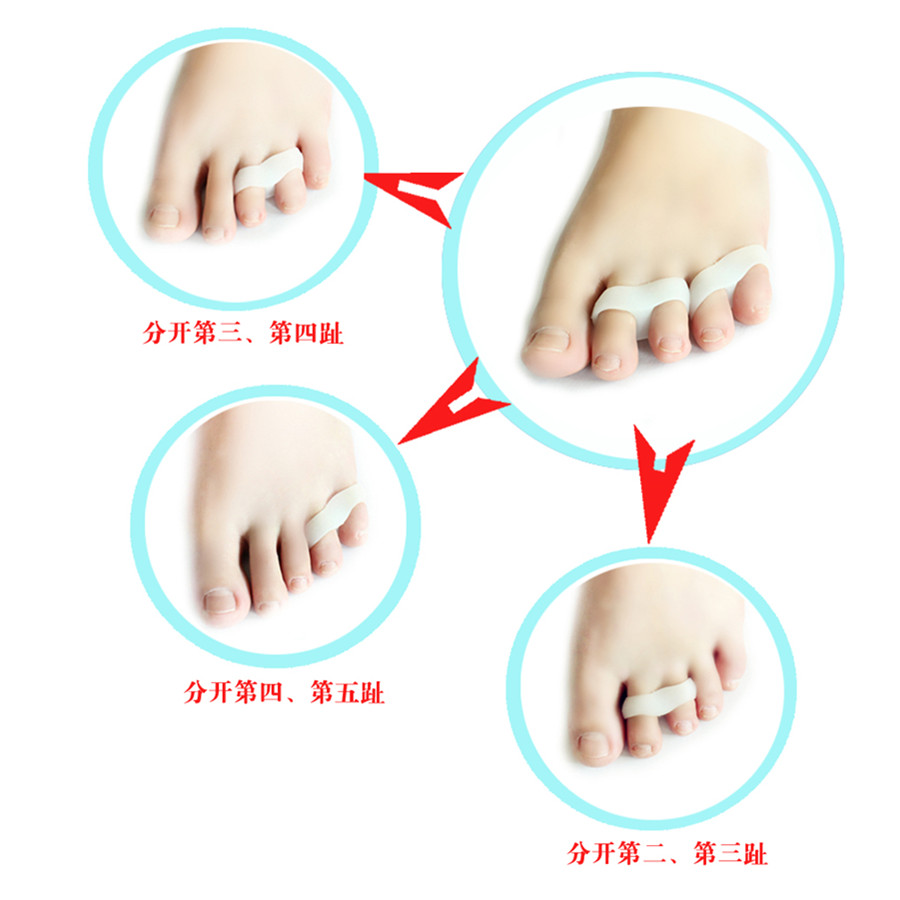 2pcs pedicure silicone gel Small toe overlap foot ... – Grandado