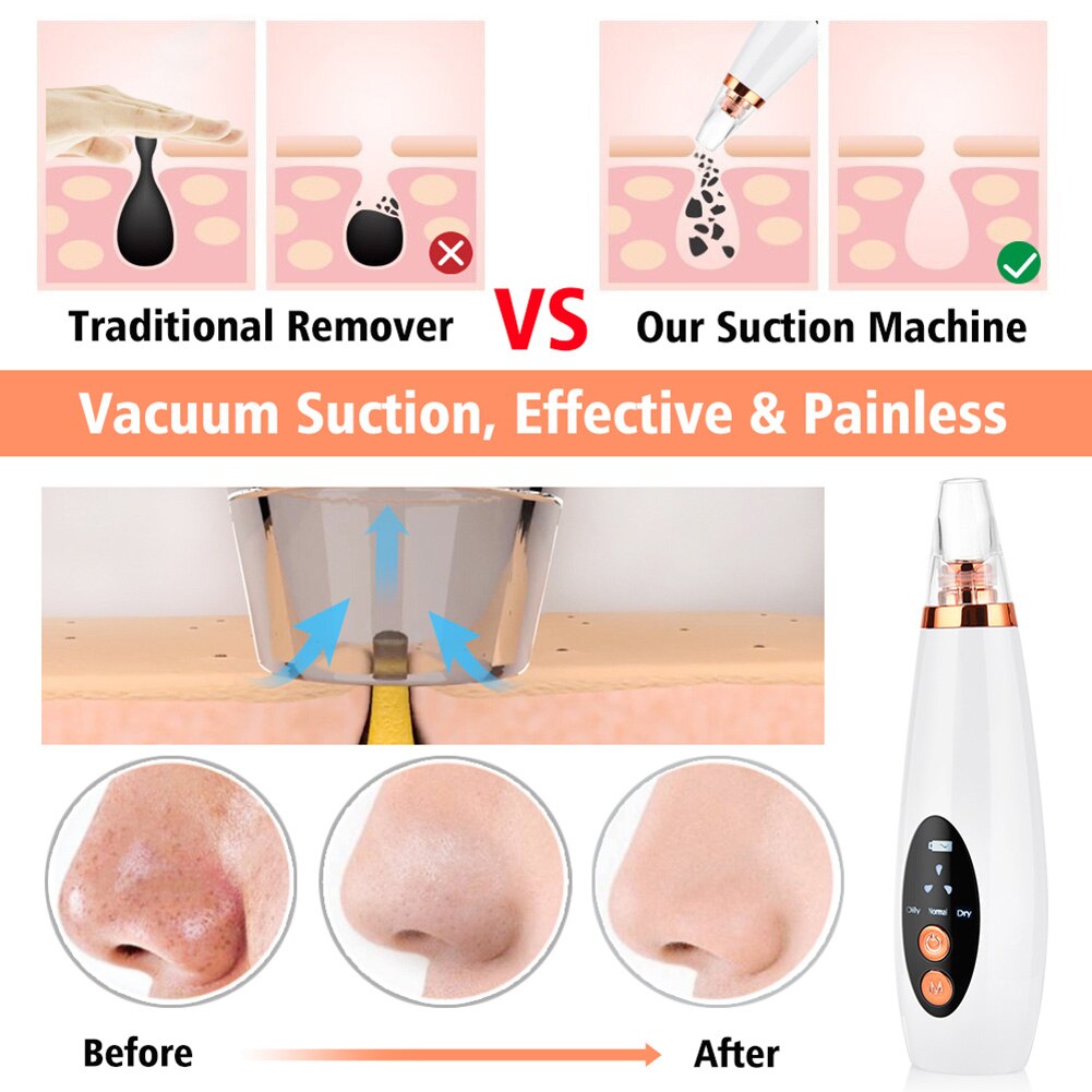 Electric Blackhead Black Dot Remover Face Pore Vac... – Grandado