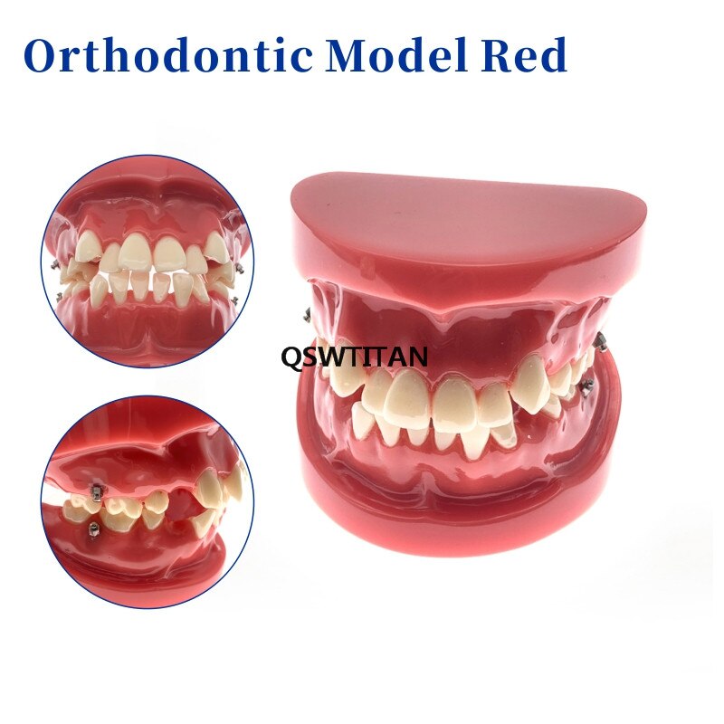 Dentist Orthodontic Tooth Model Demonstration Teac... – Vicedeal