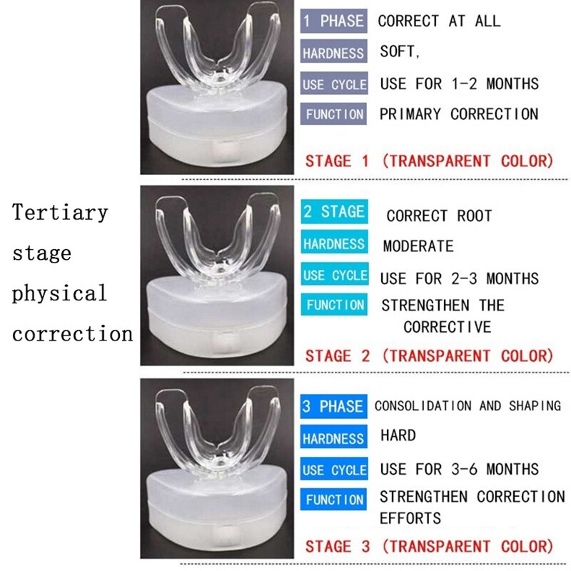 3 Stages Orthodontic Teeth Corrector Braces Tooth ... – Vicedeal
