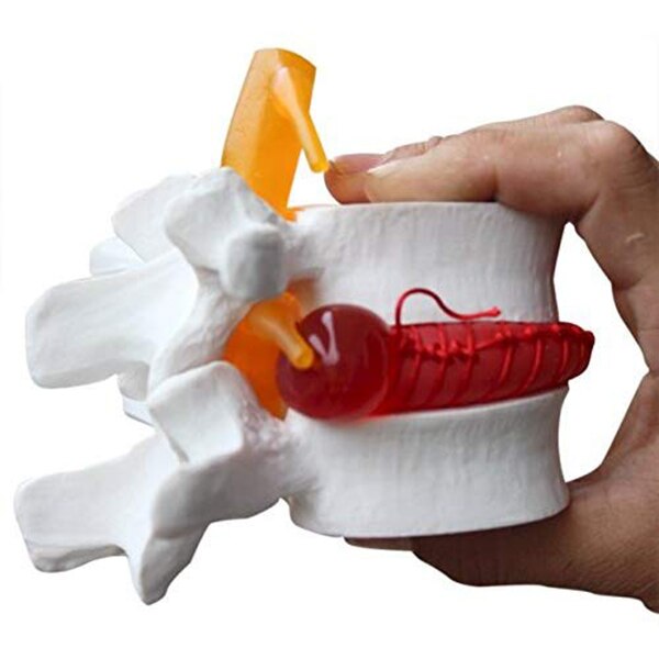 1pc Anatomical Lumbar Disc Herniation Lumbar Spine Grandado 8538