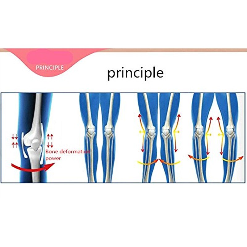 Tcare 1Pair Orthopedic Insoles Shoe Inserts Medial... – Grandado
