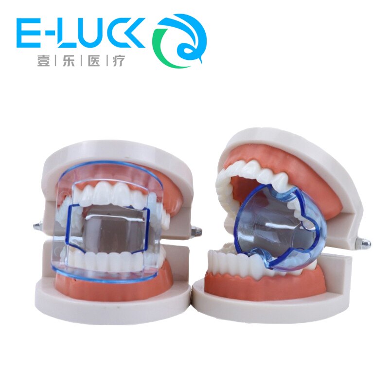 Dental Teeth Retractor Orthodontic Teeth Opening A... – Vicedeal