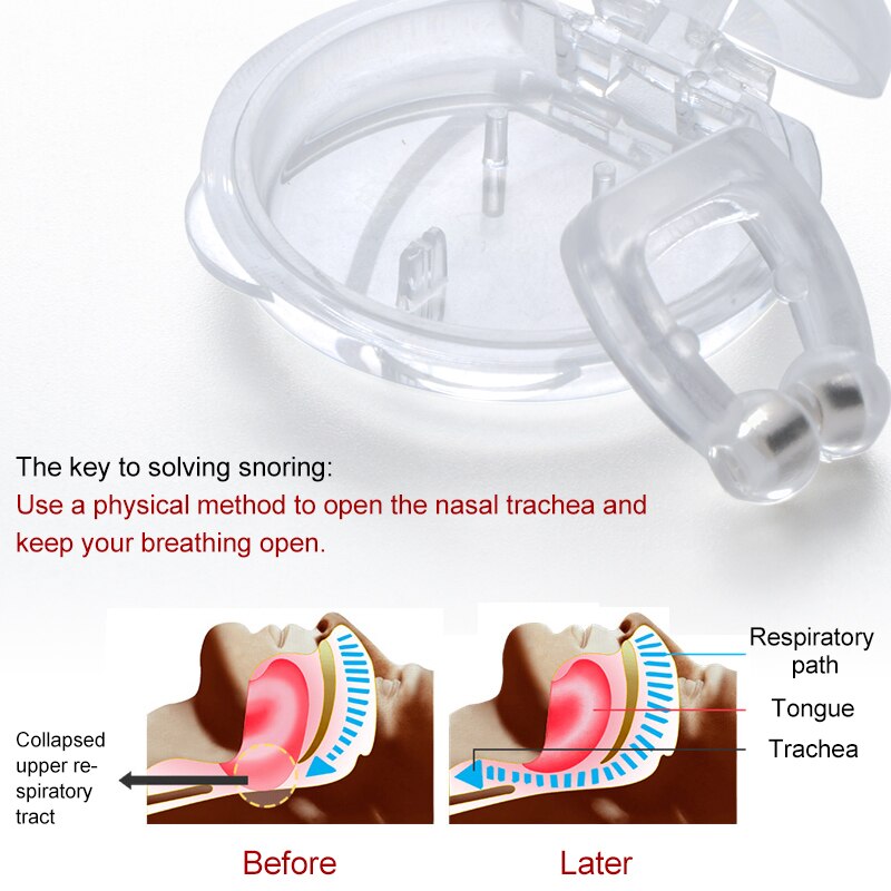 1 Pcs Anti-Snoring Apnea Sleeping Aid Device Anti ... – Grandado