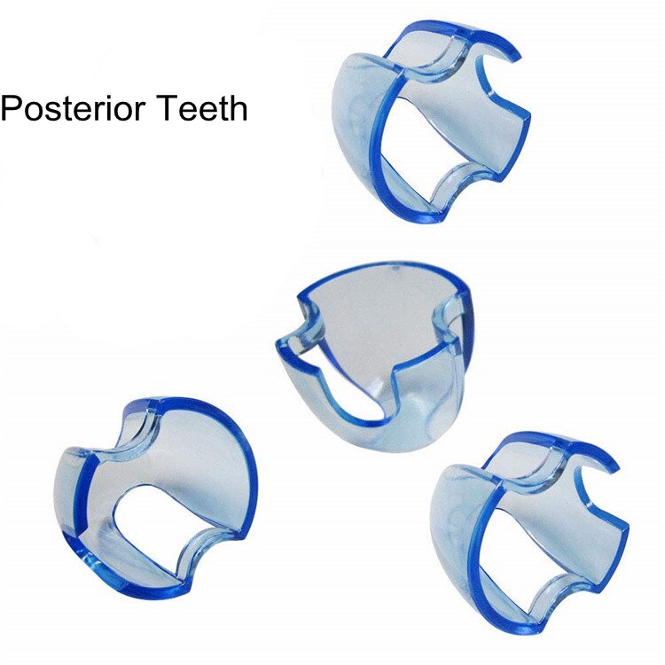 50 Stuks/partij Dental Ortho Mond Gag Opener Retra... – Vicedeal