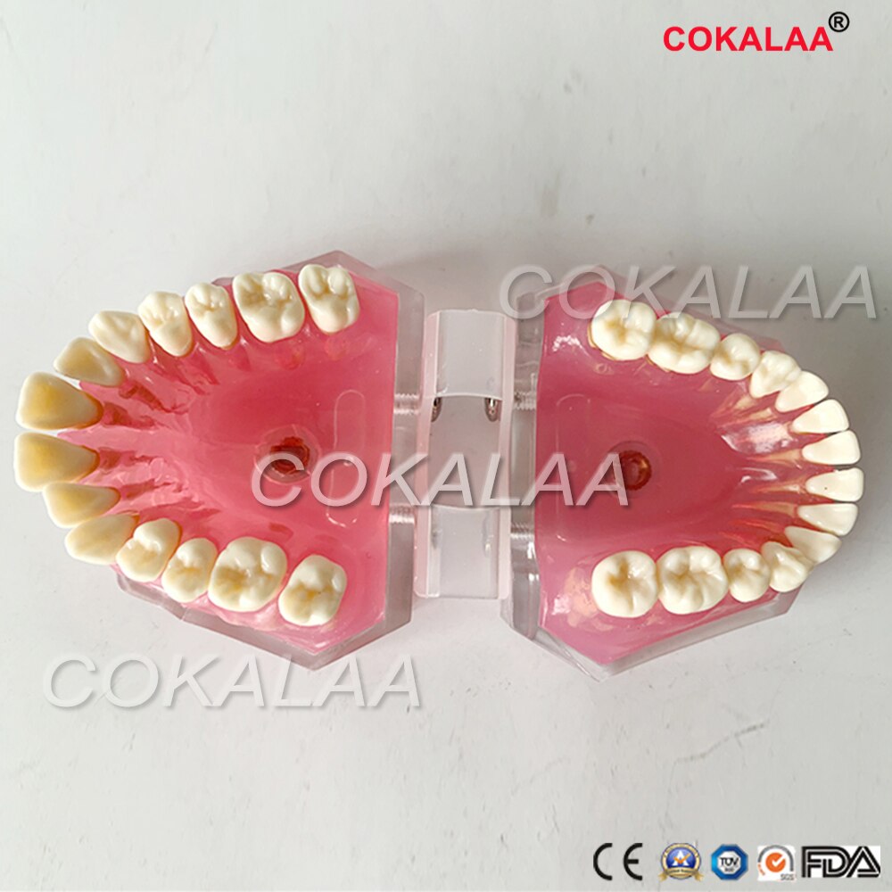 Dental Study Teaching Model Standard Model Removab... – Grandado