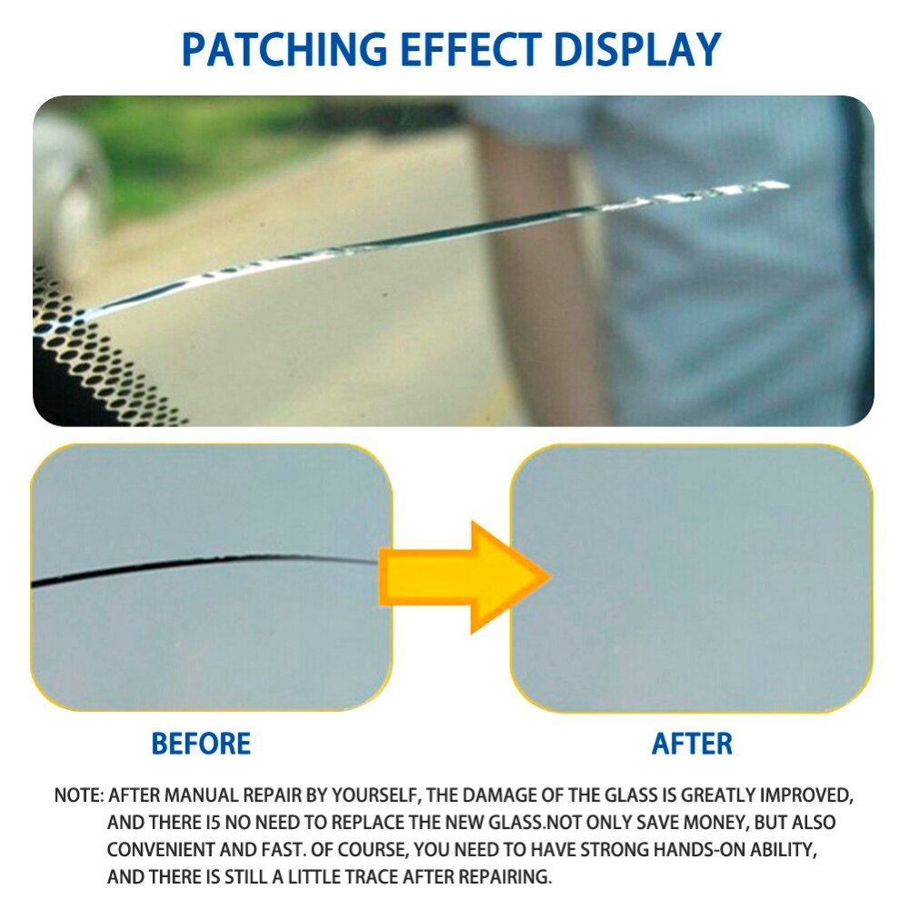 Set for repair of chips and cracks auto glass wind... – Grandado