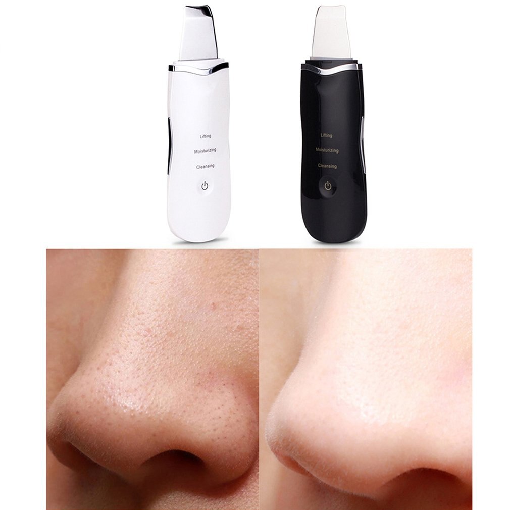 Ultrasonic Blackhead Clean Shovel Skin Cleansing I... – Grandado