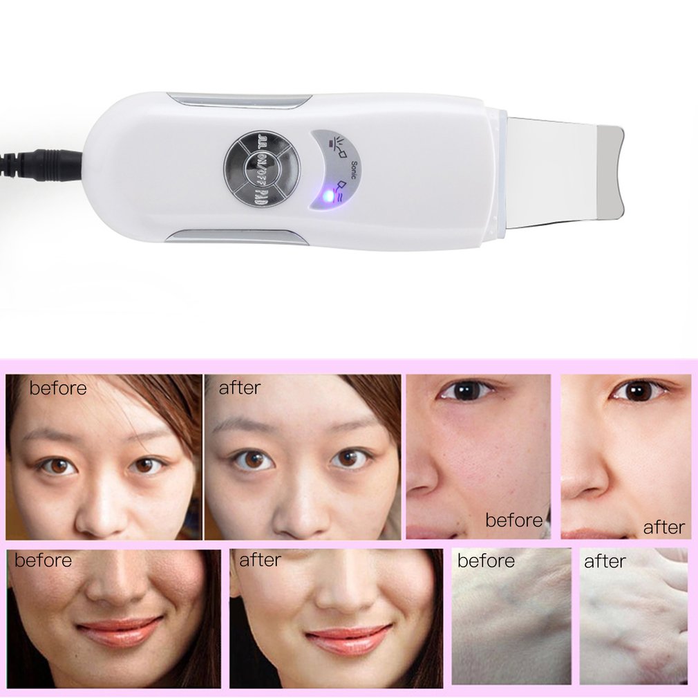 Skin Scrubber Ultrasonic Micro Electric Facial Dea... – Grandado