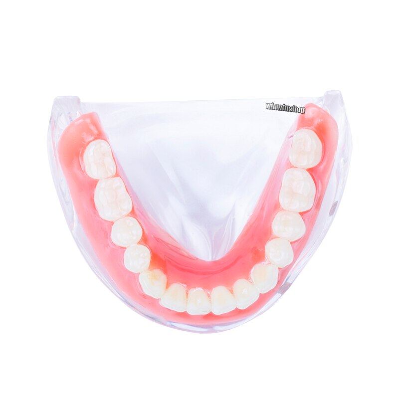 Tandheelkundige Overkappingsprothese Tanden Model ... – Vicedeal