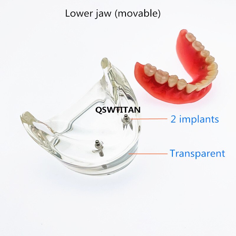 Dental Teeth Model Removable Interior Mandibular D... – Grandado