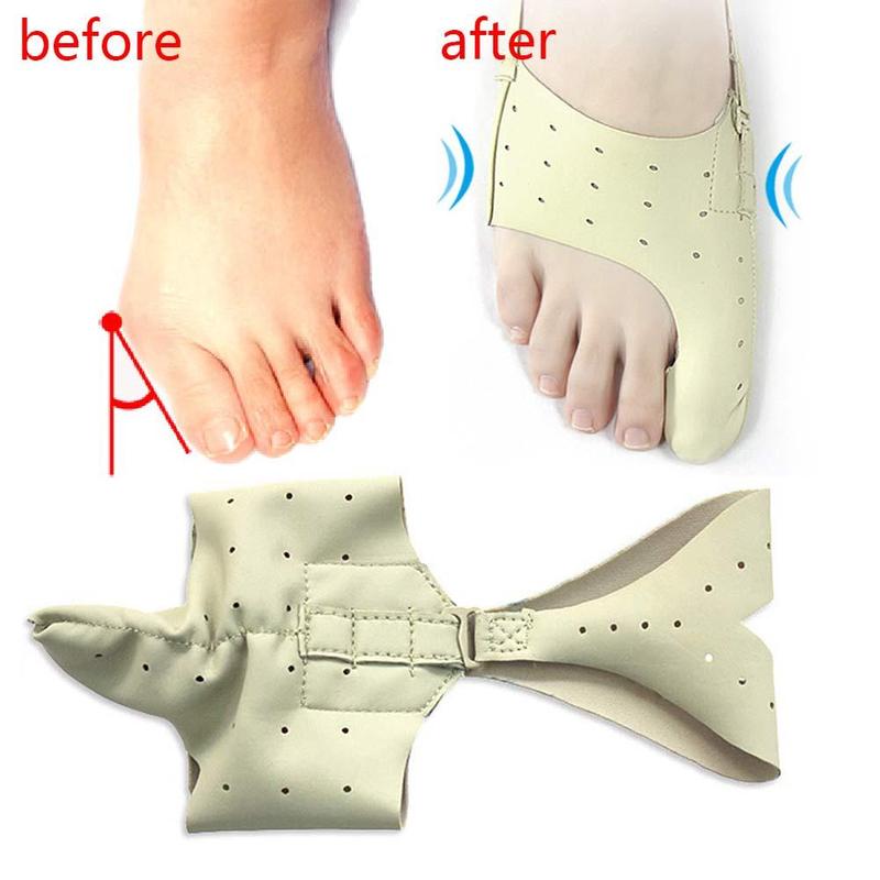 Hallux Valgus Bunion Corrector Orthopedic Foot Too... – Vicedeal